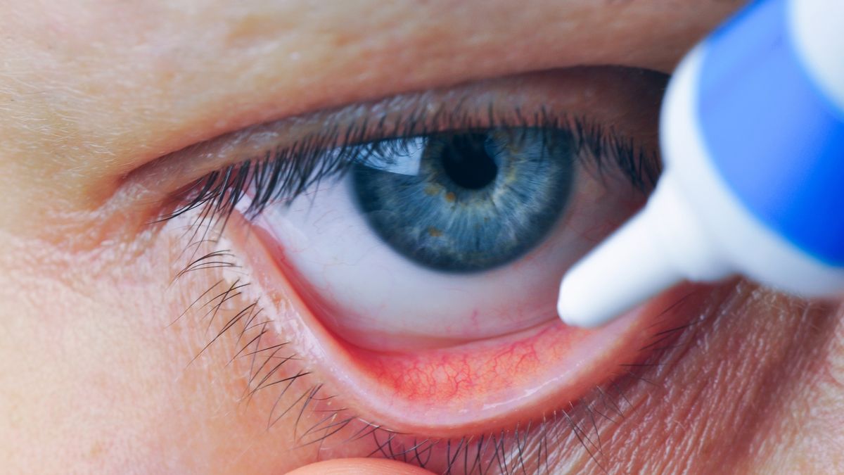 Why Aren't My Eye Drops Working? | Duly Health and Care